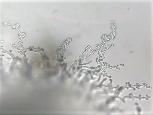 Obecná mikrobiologie I