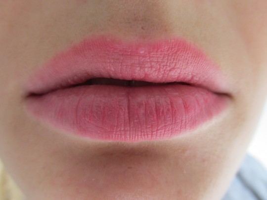 Anatomy and Physiology of Oral Cavity, Anomalies