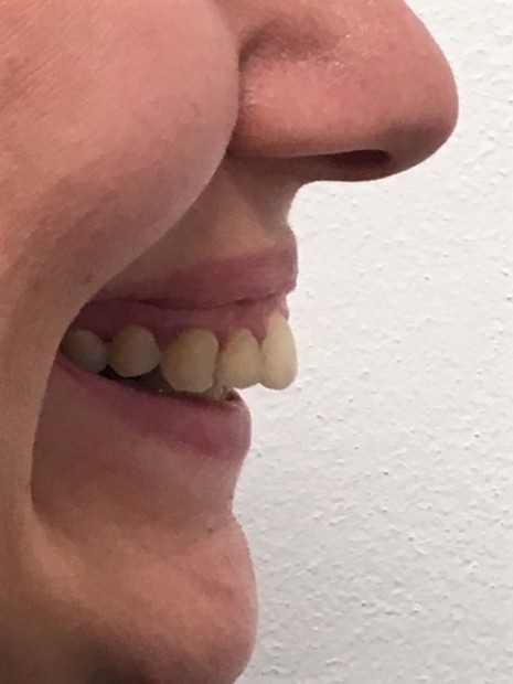 Anatomy and Physiology of Oral Cavity, Anomalies