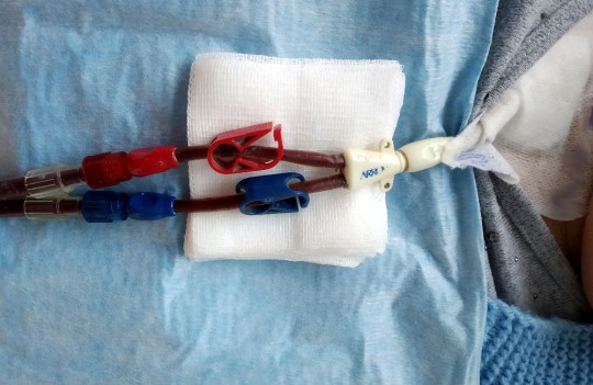 Ošetřovatelství v chirurgických oborech – 2. část