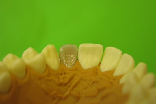 Kombinované korunky