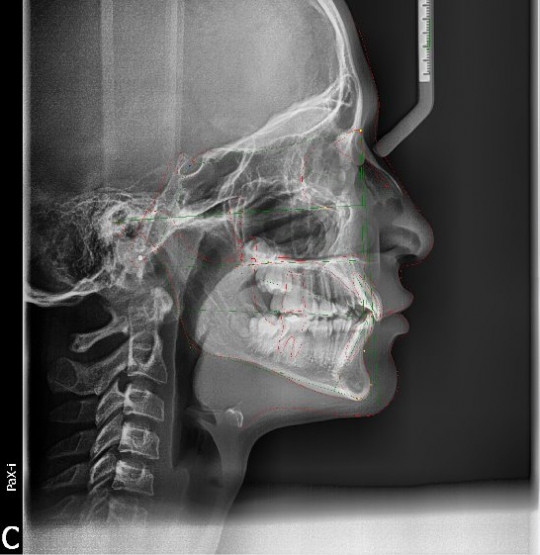 Rentgenologie pro dentální hygienistky