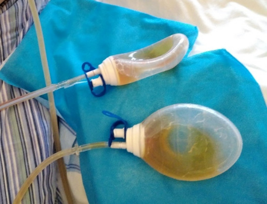 Kompletní monitoring nemocného na JIP II.